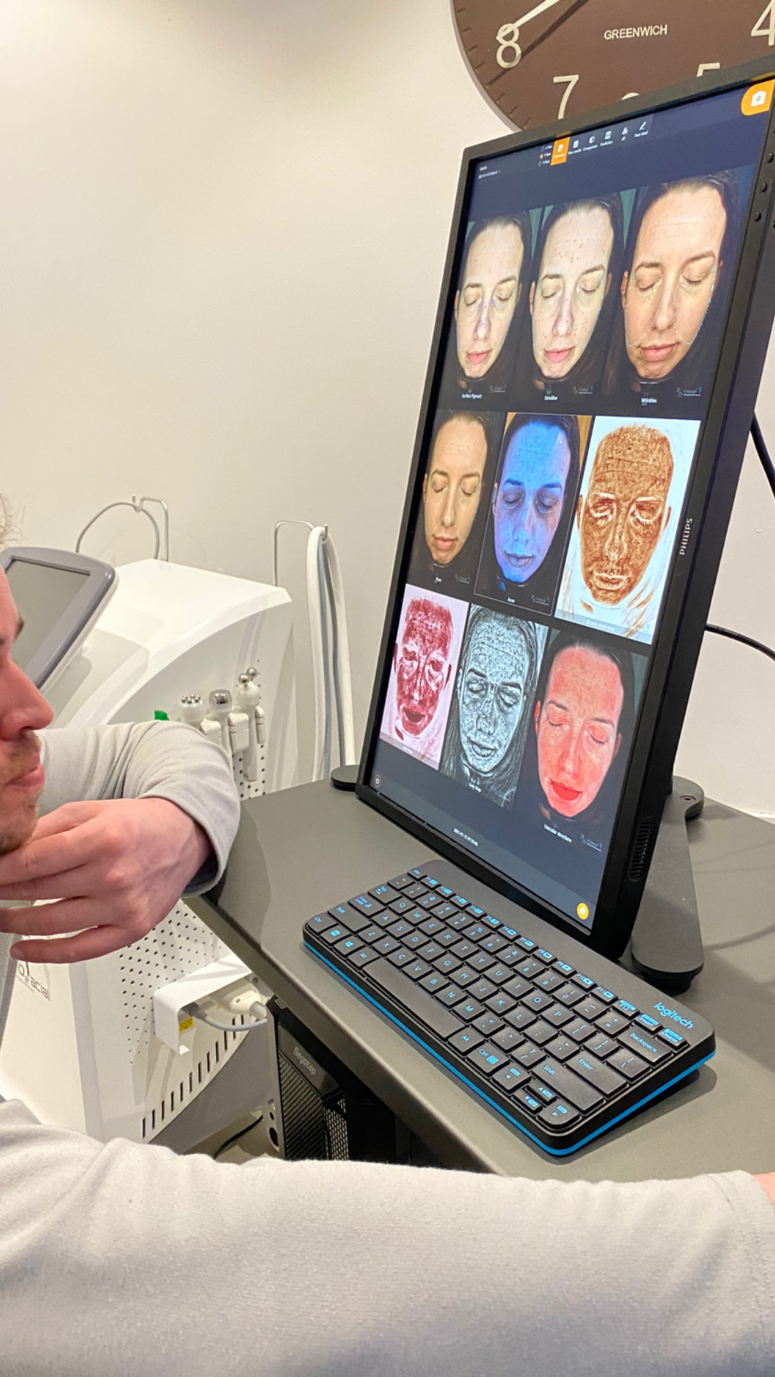 What lies beneath? Why skin analysis is so good | Podology - Chiropody ...